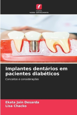 Implantes dentários em pacientes diabéticos [Portuguese], Ekata Jain ...